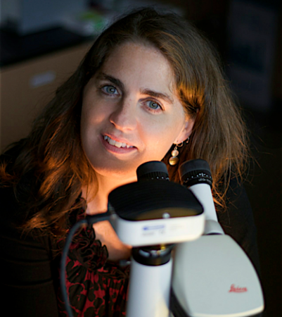 U of G Expert Available for World Kidney Day - U of G News