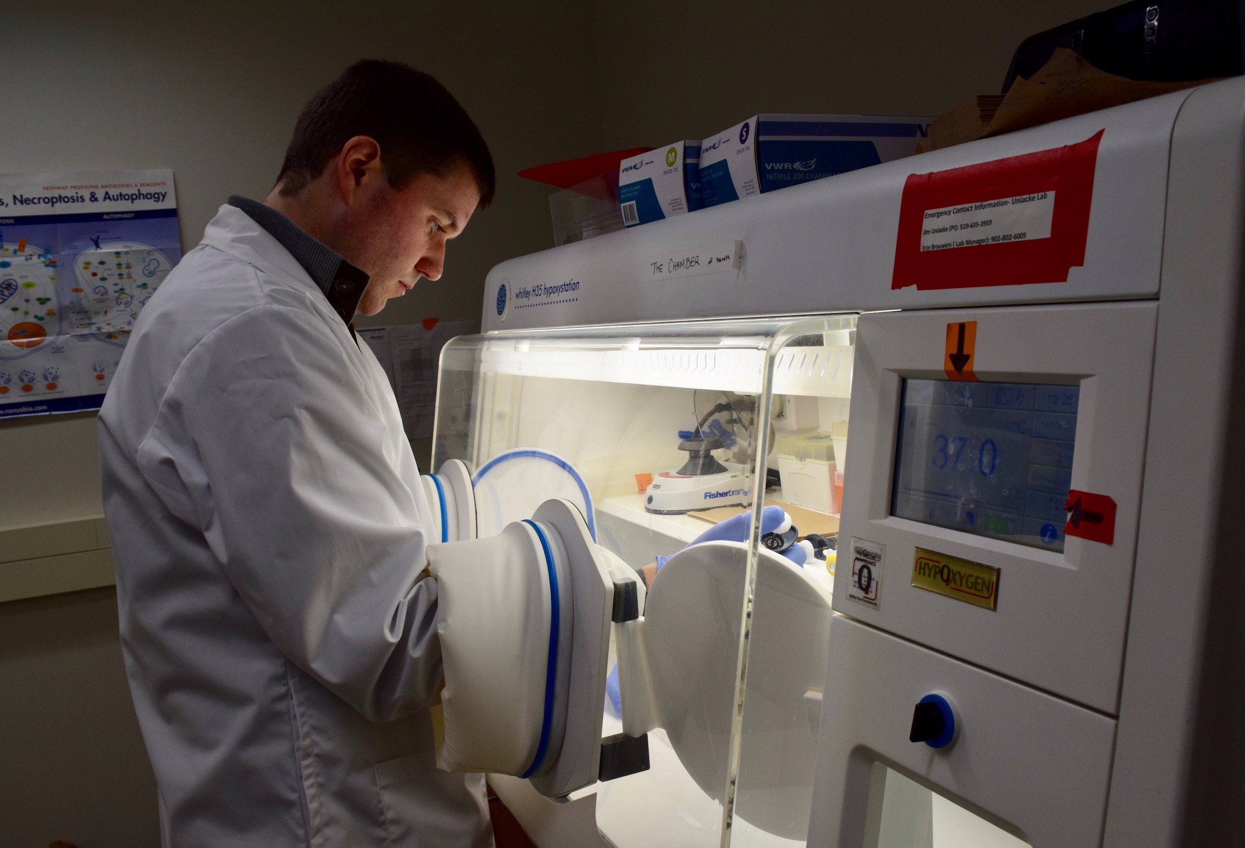 U of G Prof Identifies Protein Key to Spread of Cancer Cells - U of G News